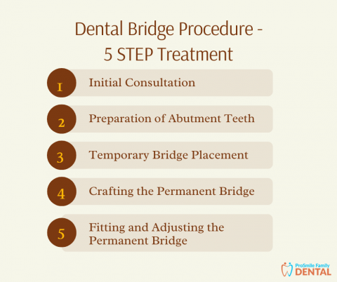 Dental Bridge Procedure - Step By Step Guide for Beginners