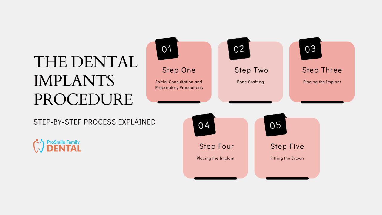 Dental Implant Procedure - The Ultimate Guide [2023]