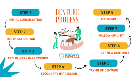 The Complete Denture Process - Step By Step Guide [2024]