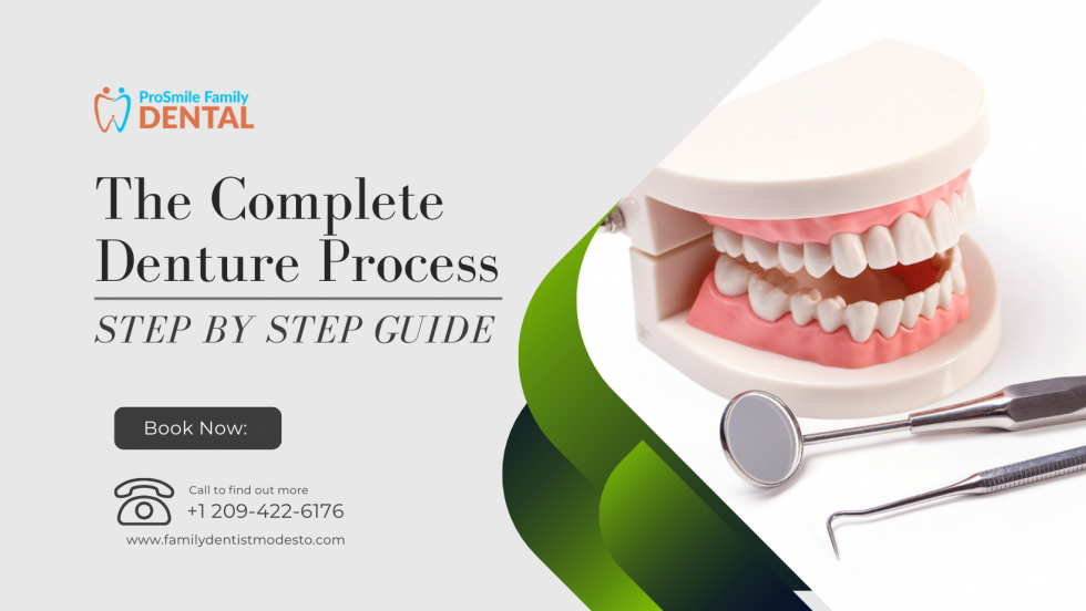 The Complete Denture Process - Step By Step Guide [2023]