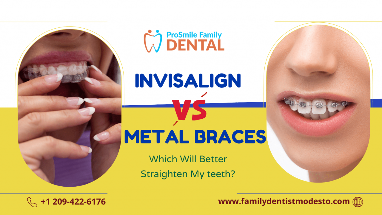 #1 Rated Dentist in Modesto, CA - ProSmile Family Dental Care